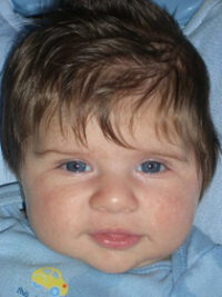 Eggplant Babies – Scalinis Italian Restaurant